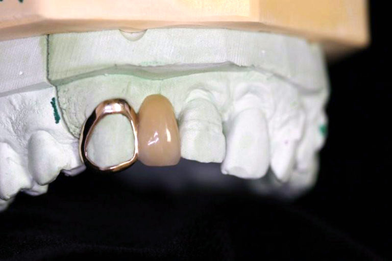 Products – Team Root