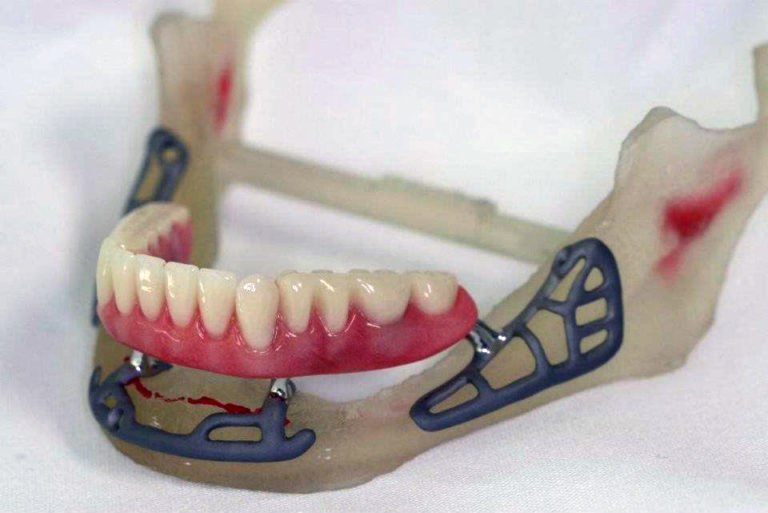 Products – Team Root